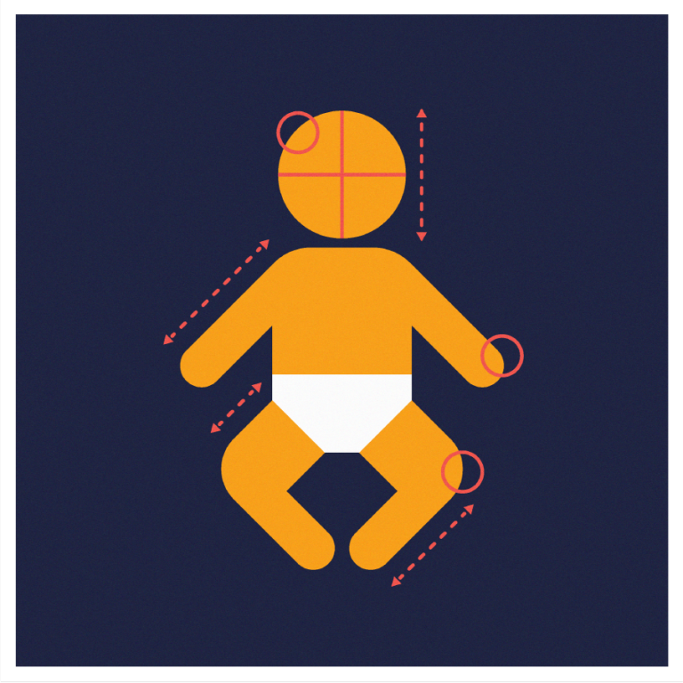 Dysmorphic Features in Children - Learn with OPEN